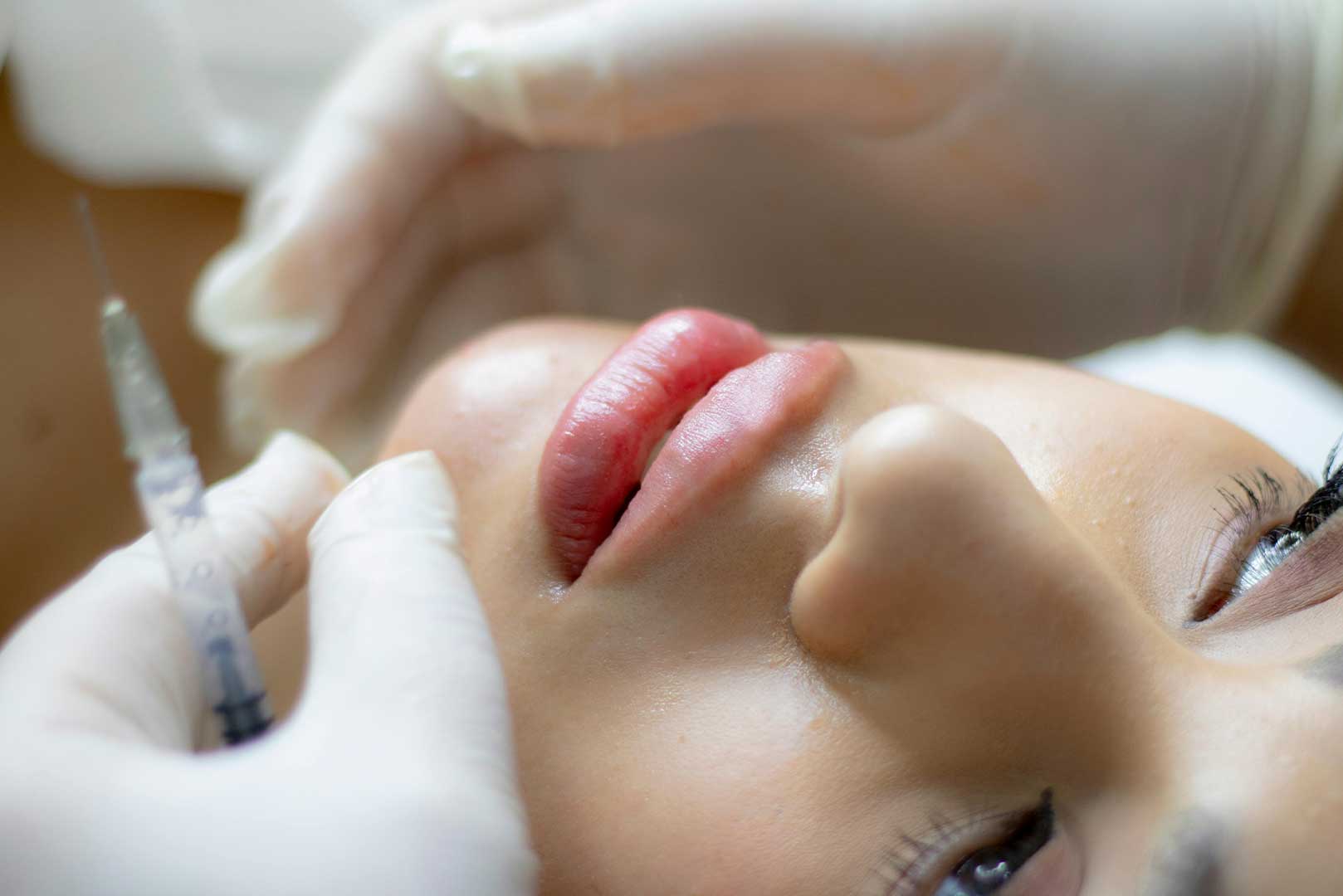 Ácido Hialurónico Inyectable en 2025: Innovación y Resultados Seguros